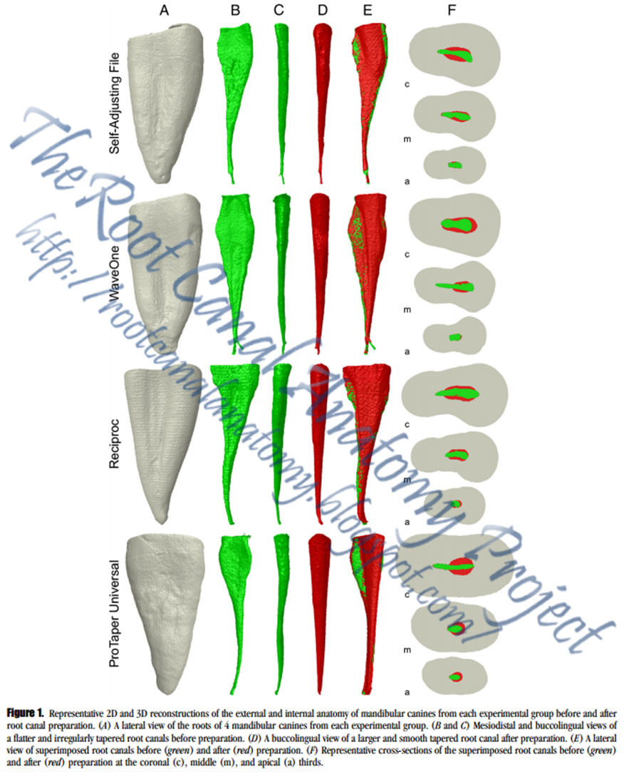 The Root Canal Anatomy Project: August 2013